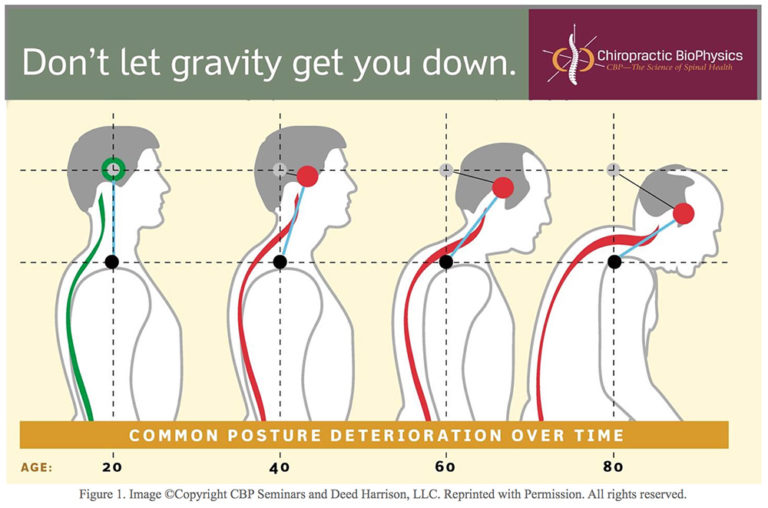 Anterior and Vertical Translations of the Cervical Spine Increase ...