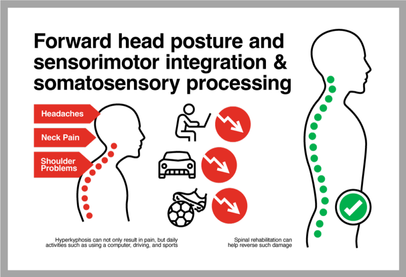 Understanding the Impact of Forward Head Posture on Sensorimotor ...